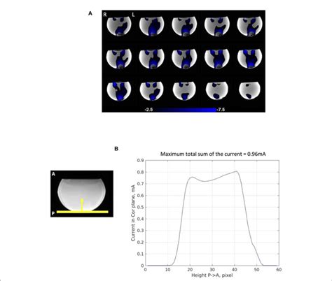 Figure Current Distribution In Phantom Experiment A Average Current