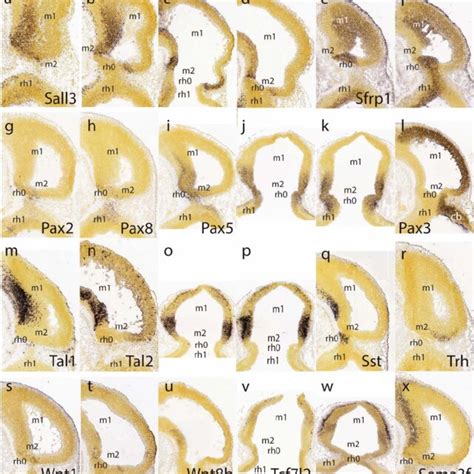 Plate Illustrating Diverse E115 Mouse Brain Sagittal A I L N Q U