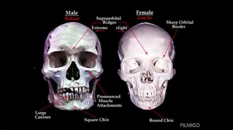 Skull Shape By Sex Gender Youtube