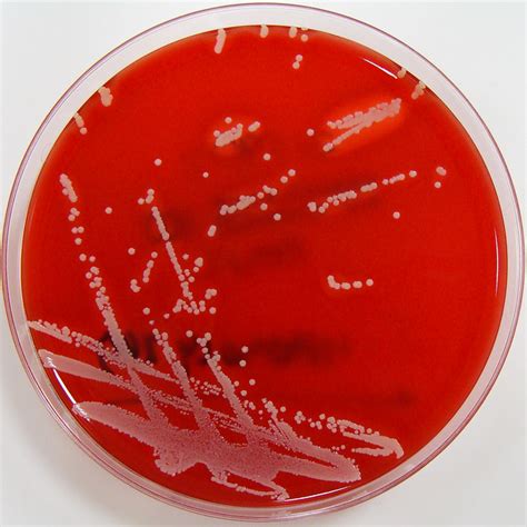 Staphylococcus Haemolyticus