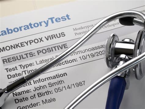 Monkeypox Chickenpox Or Shingles Infectious Diseases Experts Explain