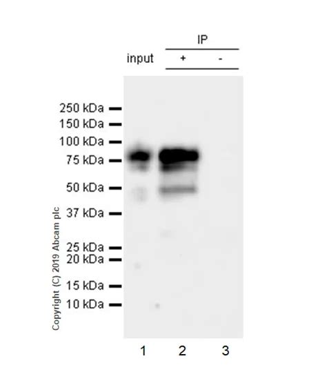 Anti Il 6r Antibody [epr22628 236] Ab222101 Abcam