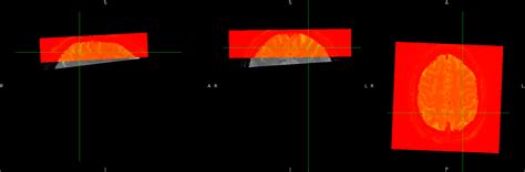 Fmriprep Coregistration Issues With Functional Slab Software Support