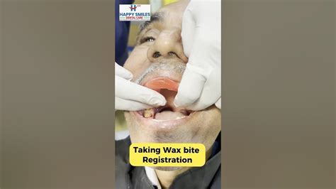 Perfect Bite Begins Here Wax Bite Registration At Happy Smiles Youtube