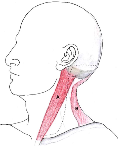 Occipital Lymph Node Location