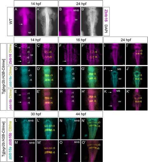 Figure 1 From Zbtb16 Mediates A Switch Between Fgf Signalling Regimes