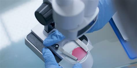 The Importance Of Cytology Tests In Healthcare Sbmf