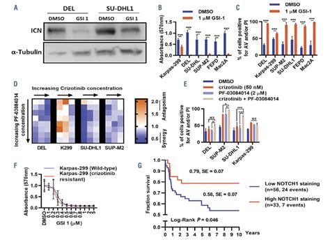 Alk Inhibitor Sensitive And Resistant Anaplastic Large Cell Lymphoma