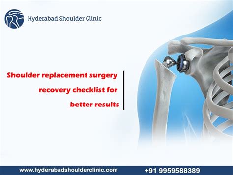 Shoulder Replacement Surgery Recovery Checklist For Better Results