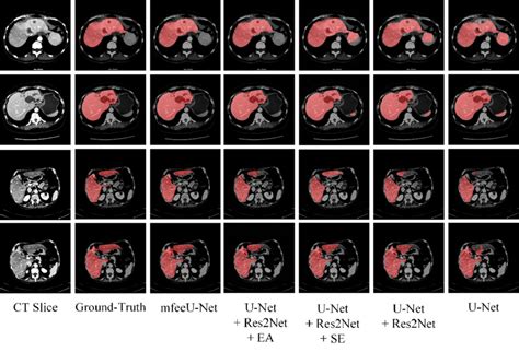 2d Liver Segmentation On Ct Slices Of A Ct Volume Using Different Download Scientific Diagram