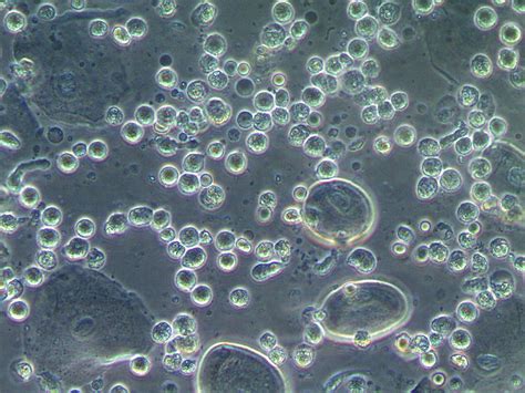 Parabasal Cells On Wet Mount