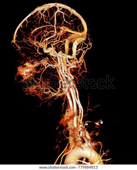 Neck Mri Over 191 Royalty Free Licensable Stock Illustrations