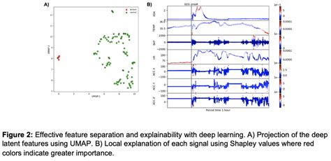 Seizure Detection And Feature Explainability From Long Term Trends In
