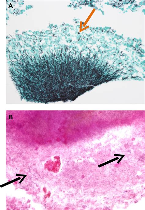 Figure 1 From Overview Of The Different Species Of Actinomyces Bacteria
