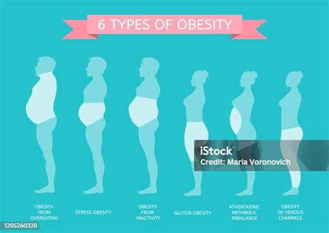 6 Jenis Obesitas Sosok Pria Dan Wanita Dalam Profil Ilustrasi Stok