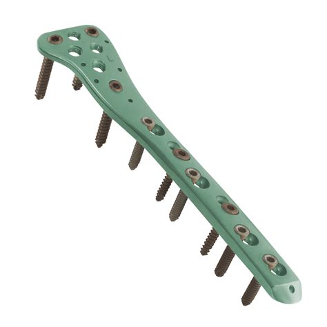 Condyfix Placa Bloqueada Alp Para Fémur Distal Traufix México