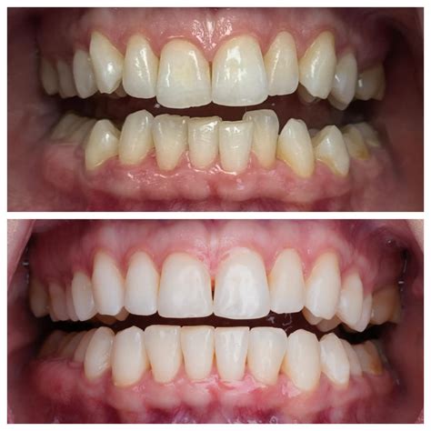 Dr Hussein Daher Dds Daher Dental • Instagram Photos And Videos