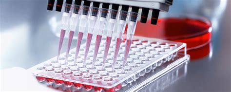 The Best Cho Expression System Kits On The Market Proteogenix