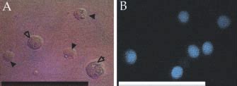 A B Isolation Of Sperm Cells A Differential Interference Microscopy Download Scientific