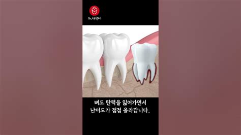 사랑니 빼기 가장 좋은 나이 Shorts Youtube