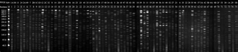 Gel Image Of Pfge Result Genomic Dna Was Digested Using Xbai Enzyme