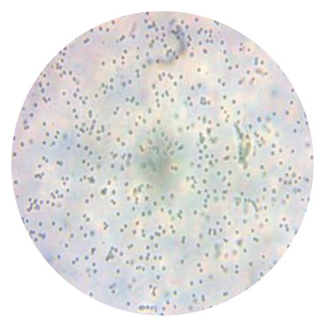 In Vitro Biocontrol Evaluation Of Some Selected Trichoderma Strains Against The Root Pathogen