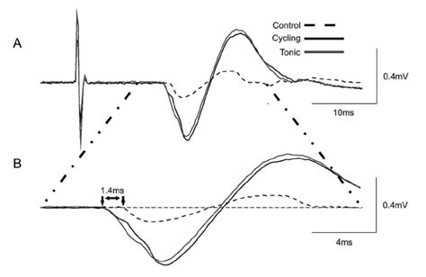 Corticospinal Excitability Is Increased Before Movement Onset A Download Scientific Diagram