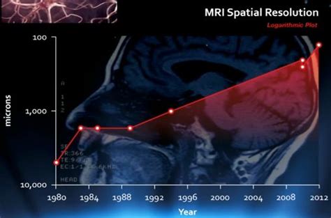 Spatial Resolution Of Mri From 1980 To 2012 Mri Paradigm Shift Spatial