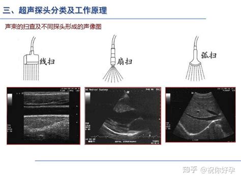 超声成像的基本原理 知乎