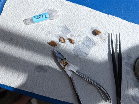 Dual Dna And Rna Extraction Protocol Sarah Tanjas Open Lab Notebook