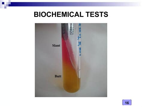 Medical Microbiology Laboratory Vibrio Spp Pdf