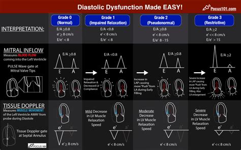 Diastolic Dysfunction Calculator Pocus 101
