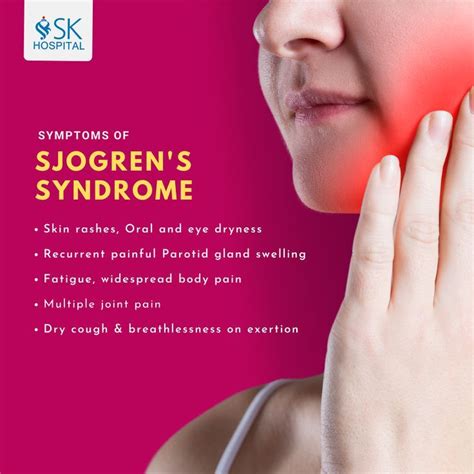 Pin By Shellie Sackmann On Autoimmune Sjogrens Syndrome Autoimmune