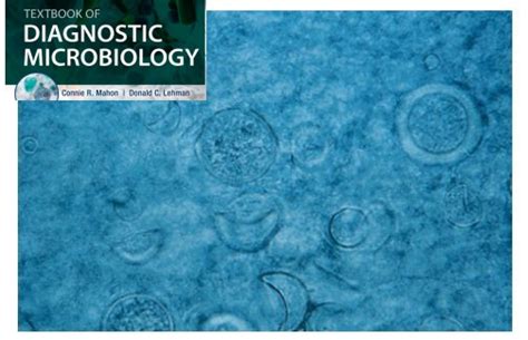 نمای میکروسکوپی گونه های کوکســیدیوئیدس Coccidioides Spp آزمایشگاه