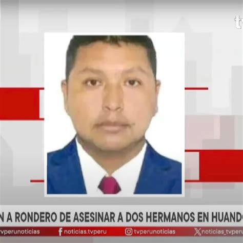 Médico Estético Se Burla Del Rostro De Janet Barboza ¡qué Miedo Hay