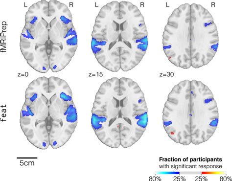 Fmriprep A Robust Preprocessing Pipeline For Functional Mri Pmc Fmriprep A Robust Preprocessing Pipeline For Functional Mri Pmc