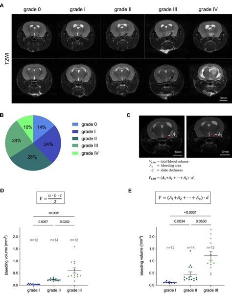 Endovascular Perforation Model For Subarachnoid Hemorrhage Combined