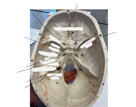 Skull Foramen For Cranial Nerves Quiz