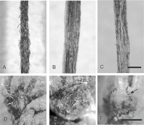 Peduncle And Bract Morphology In Cassytha Glabella And C Capillaris