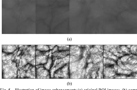 Figure 1 From Human Identification Using Palm Vein Images Semantic Scholar