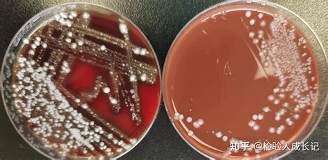 检验规培成长记 微生物检验之培养基菌落的观察 知乎