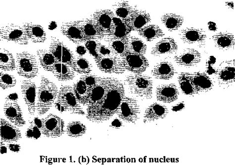 Figure 1 From Automated Classification Of Pap Smear Tests Using Neural Networks Semantic Scholar