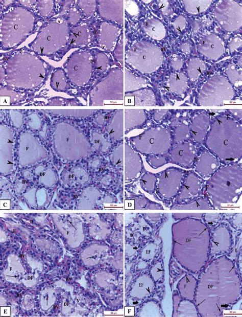 Simple Cuboidal Epithelium Thyroid