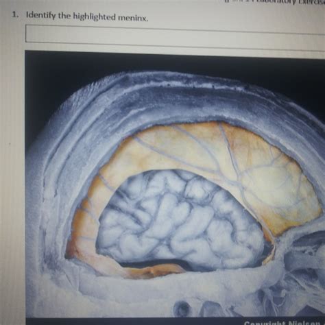 Solved Identify The Highlighted Meninx Brain
