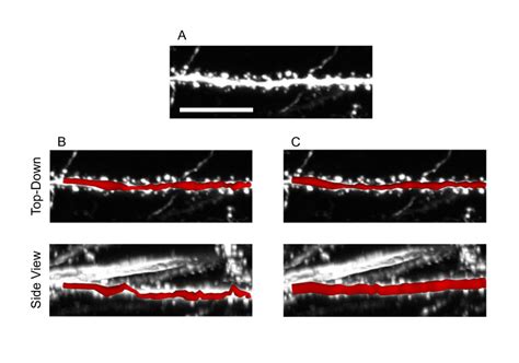 Dendritic Spine Quantification Using An Automatic Three Dimensional