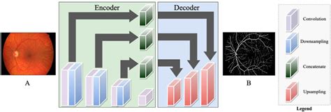 Supervised Machine Learning Approach For Retinal Vessel Segmentation A