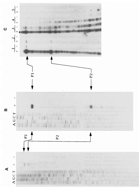 Primer Extension Analysis Total Rna Was Isolated From 5 Anthracis