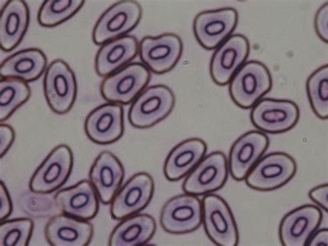 What Are The Best Conditions For Capture Imaging By Microscope In The