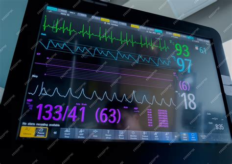El Monitor Del Hospital Muestra Los Signos Vitales La Frecuencia