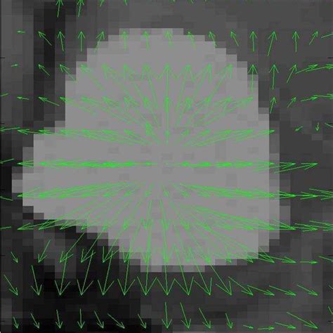 atlas seeding lesion growth and deformation field analysis a warped